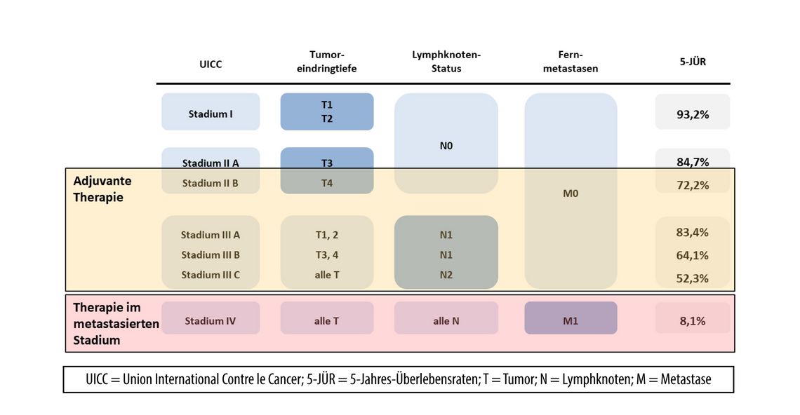 Lokal begrenztes Kolonkarzinom: Adjuvante und neoadjuvante Therapie