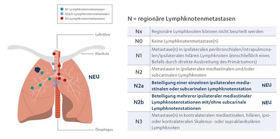 Nichtkleinzelliges Lungenkarzinom (NSCLC) im Stadium I bis III - Präzisere Therapie durch ...