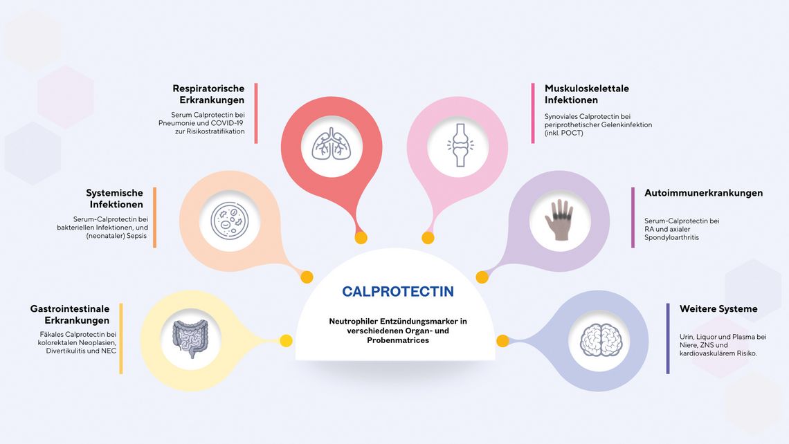 Entzündungsmarker Calprotectin: Jenseits der CED-Diagnostik